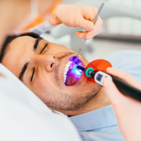 Light Cure Filling | Nashik Dentist